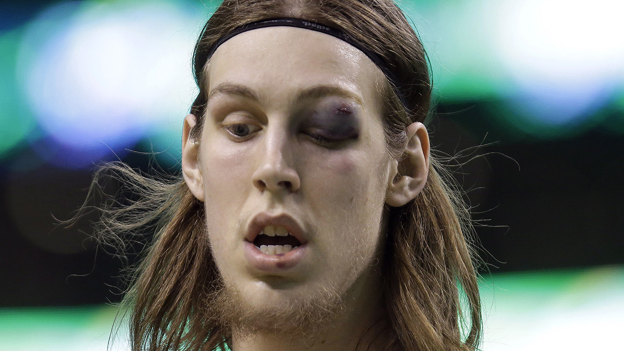 Celtics’ Olynyk reveals Dougie Hamilton’s injury