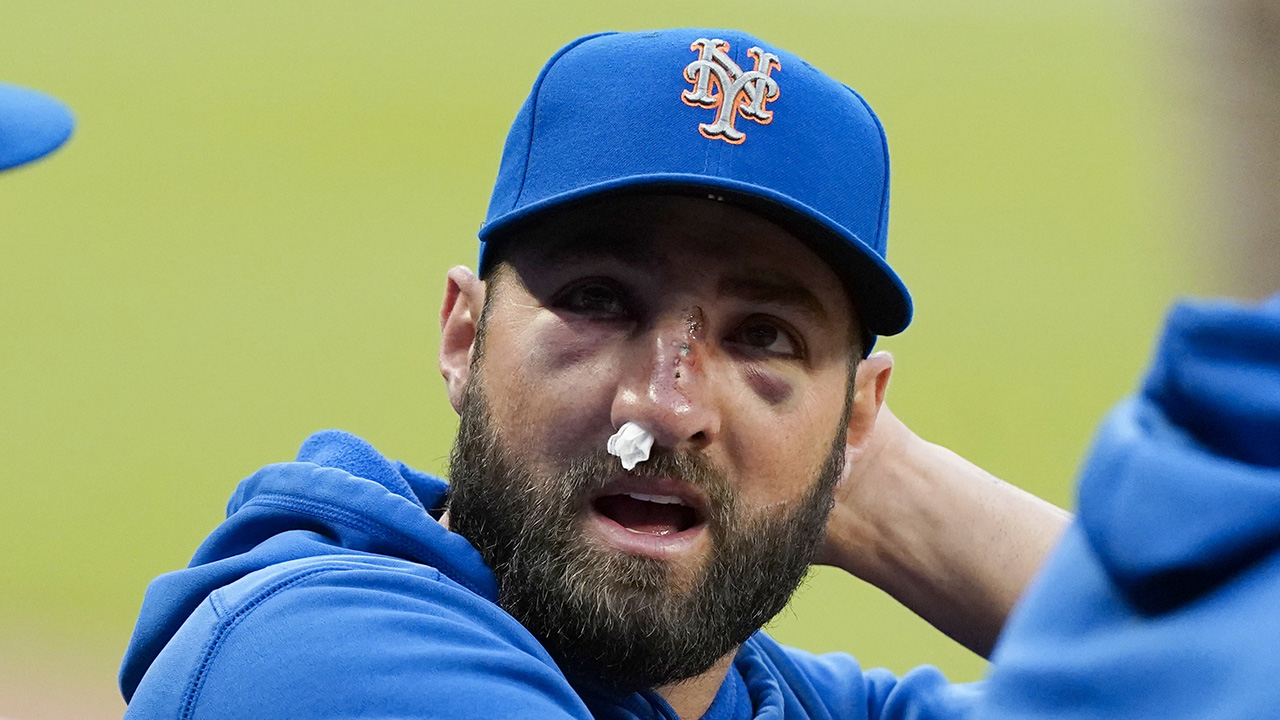 Mets' Pillar suffers multiple nasal fractures after being hit by pitch - Sportsnet.ca